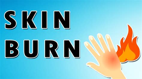 Skin Burn Clip Art