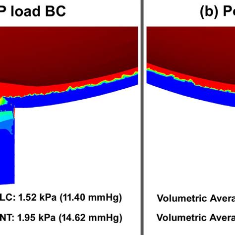Contour Maps Of Pressure In The Donor 118 Fe Model In Sitting Body Download Scientific Diagram