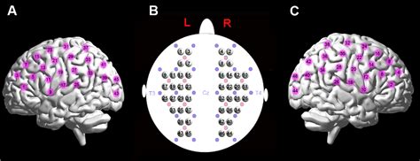 Figure 2 From Test Retest Reliability Of Graph Metrics In Functional Brain Networks A Resting