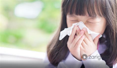 Хүүхдүүдийн дунд вирусийн гаралтай нүдний өвчлөл нэмэгджээ