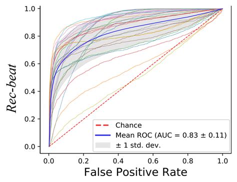 Sensors Free Full Text Heartbeat Detection By Laser Doppler Vibrometry And Machine Learning