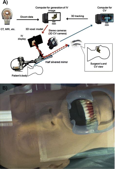 The Physical Setup Of The System A The Configuration Of The Markerless Download Scientific