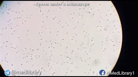 Espermatozoides Observados Con El Microscopio Optico YouTube