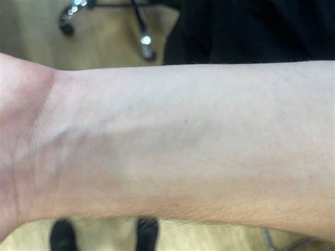 Wrist Object Detection Dataset By Project Ppvtk