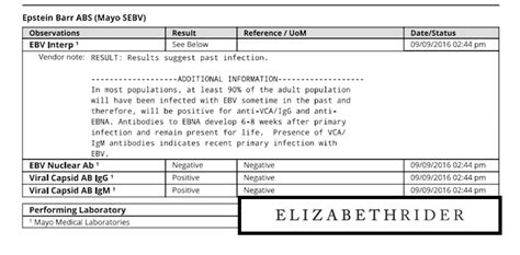 How To Read Ebv Interpretation Chart A Visual Reference Of Charts Chart Master