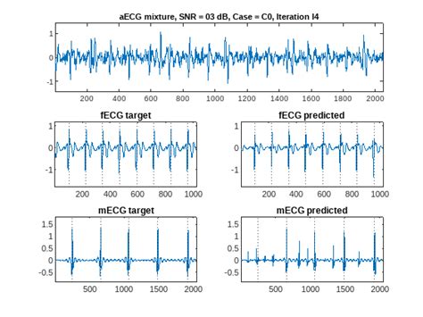 Signal Source Separation Using W Net Architecture Matlab And Simulink