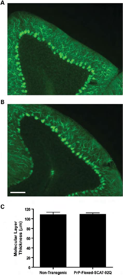 Figure 1 From Reduction Of Mutant Ataxin 7 Expression Restores Motor Function And Prevents