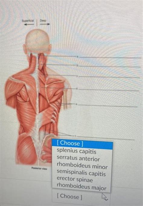 Solved 11 [choose ] Splenius Capitis Serratus Anterior