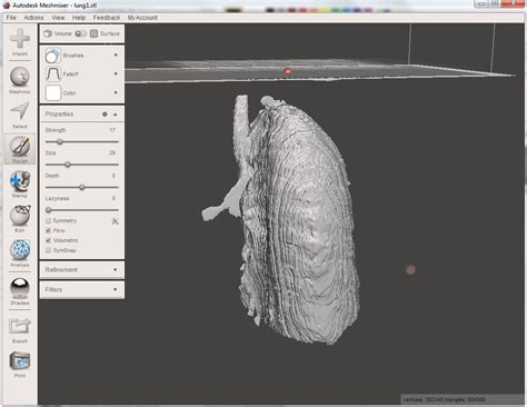 Worked Example 3d Slicer Lung