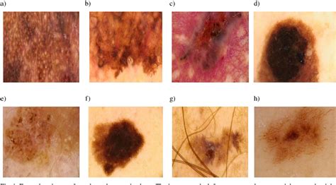 Figure 1 From Ensemble Of Classifiers Based On Deep Learning For Medical Image Recognition