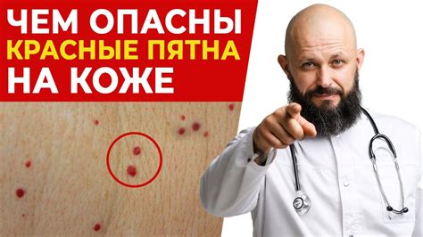 Красные пятна на теле причины и что делать