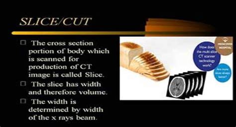 Download Free Medical Computed Tomography Ct Scan Powerpoint Presentation