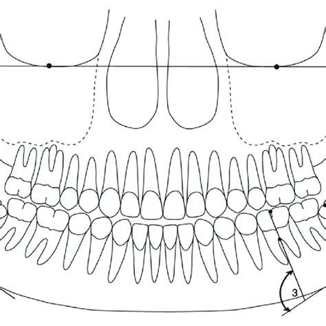 Linear Measurements Download Scientific Diagram