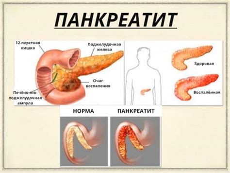 Болит желудок после алкоголя симптомы и эффективное лечение
