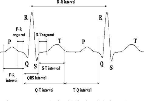 Figure 1 From Classification Of Normal And Abnormal Ecg Signals Based On Their Pqrst Intervals