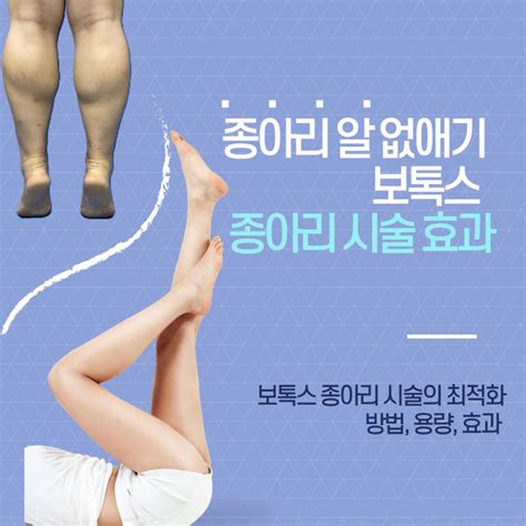 종아리 알 없애기 보톡스 종아리 시술 효과 Grityogurt