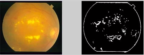Matlab How To Remove Outline Circle In This Image Stack Overflow