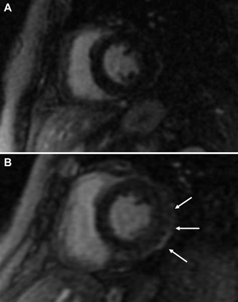 Cardiac Magnetic Resonance Imaging Download Scientific Diagram