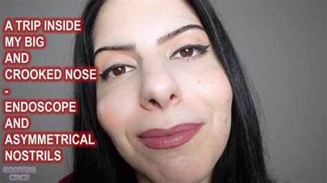 A Trip Inside My Big And Crooked Nose Endoscope And Asymmetrical Nostrils Video Request