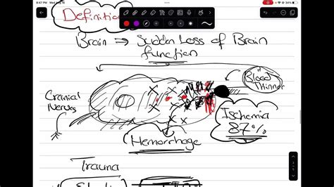 Stroke Youtube Stroke Youtube