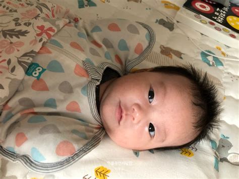 신생아 태열 관리법 아기 태열 수딩젤 네이버 블로그
