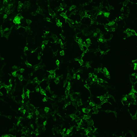 Sftsv Sftsv Non Structural Protein Cdna Clones Vg40343 Sino Biological