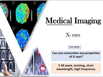 OCR A Level Physics Medical Imaging COMPLETE Teaching Resources