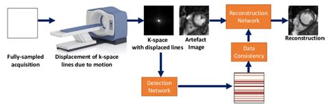 Detection And Correction Of Mr Artefacts Using Predicted Data Download Scientific Diagram