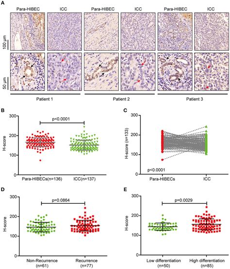 Fto Was Downregulated In Intrahepatic Cholangiocarcinoma A Fto Was Downregulated In Intrahepatic Cholangiocarcinoma A
