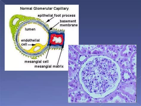 Interpretation Of Renal Biopsy Pptx