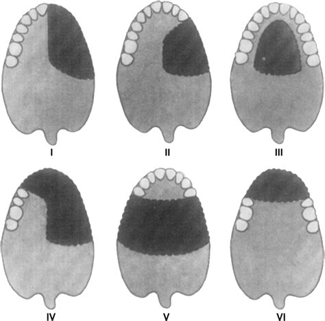 Reconstruction Of The Midface And Maxilla Facial Plastic Surgery Clinics