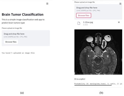 Iot Framework For Brain Tumor Classification Using Optimized Cnn Mrfo Model