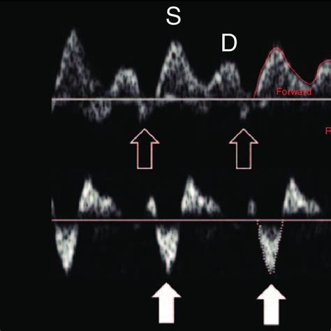 M Mode Fetal Echocardiogram Shows Both Fast Atrial And Ventricular Download Scientific Diagram
