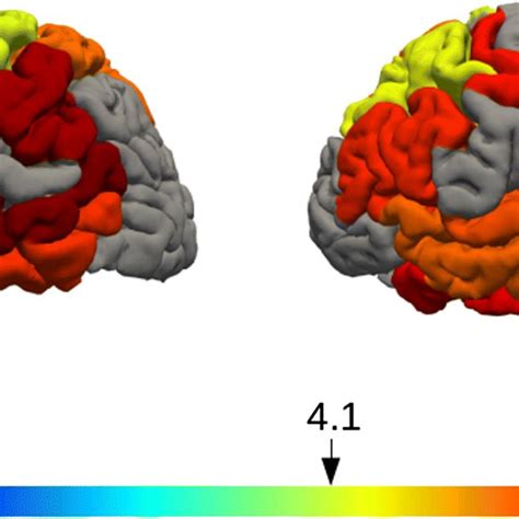 Significance Of Cortical Thickness Difference As A Function Of