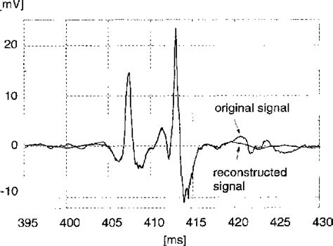 Figure 1 From Electromyogram Data Compression Using Single Tree And