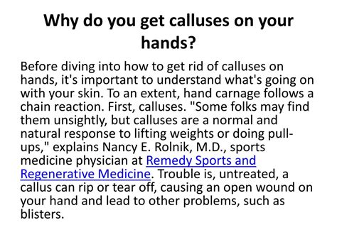 Ppt How To Avoid And Get Rid Of Calluses Powerpoint Presentation