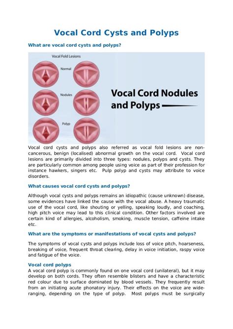 Vocal Cyst