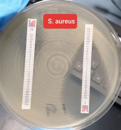 Muhammad Absar On Linkedin The Clindamycin And Erythromycin Strain