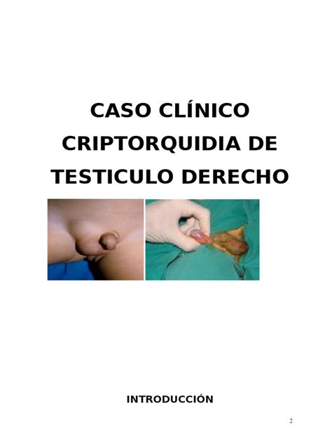Caso Clinico Criptoquidia Pdf Testículo Herida