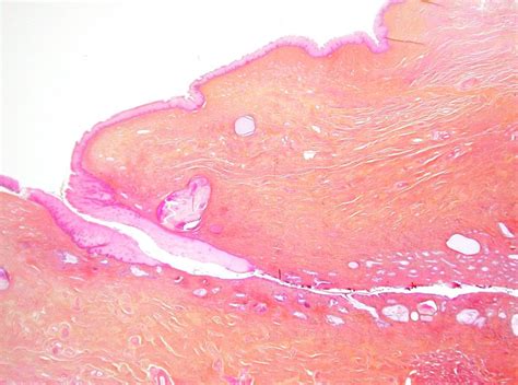 Histopathology And Cytopathology Of The Uterine Cervix Digital Atlas Glossary
