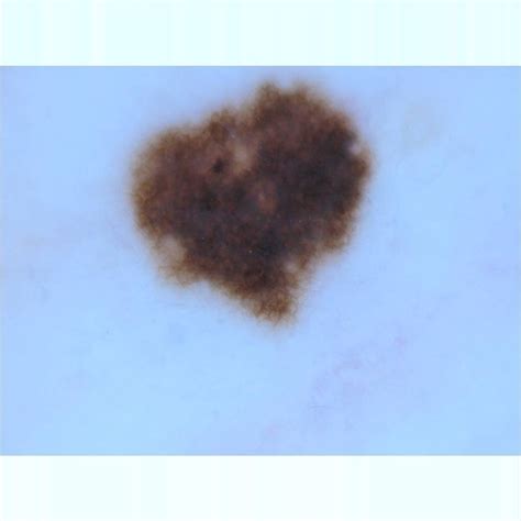 Exemplary Image With Replicate Border Padding To Equalize Width And