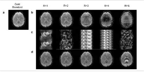 Figure 3 From Navigator Free Epi Ghost Correction Using Low Rank Matrix Modeling Theoretical
