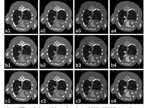 Figure 1 From Improved Material Decomposition With A Two Step Regularization For Spectral Ct