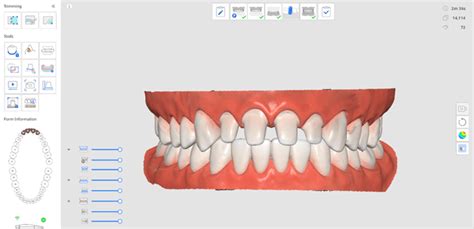 Medit Scan For Clinics Medit Intraoral Scanner And Dental Software