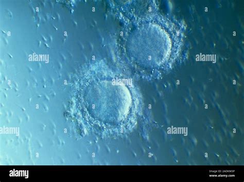 Fertilisation Light Micrograph Of Two Human Egg Cells Surrounded By