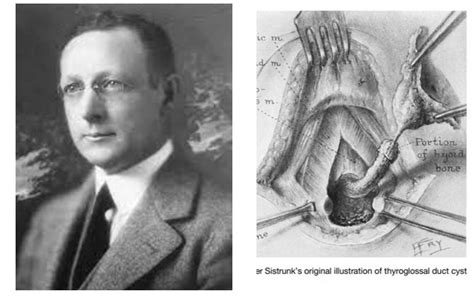 Exploring The Sistrunk Procedure An Otolaryngology History Abdelrahman R S Posted On The Exploring The Sistrunk Procedure An Otolaryngology History Abdelrahman R S Posted On The