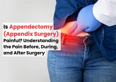 Open Appendectomy Incision