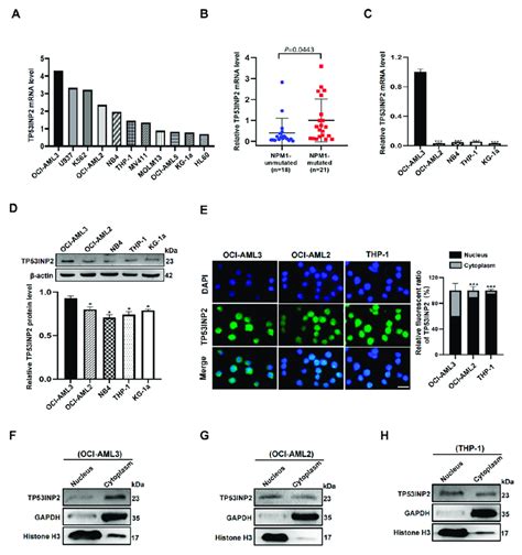 High Expression And Cytoplasmic Localization Of Tp53inp2 In Download Scientific Diagram