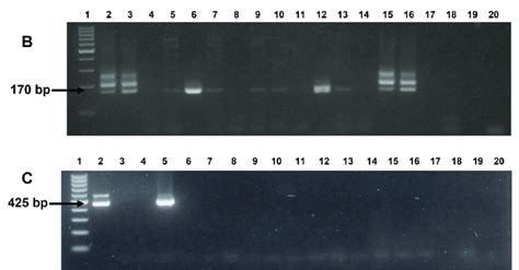 Representative Image Of Nested Pcr Amplified Products Using Primers