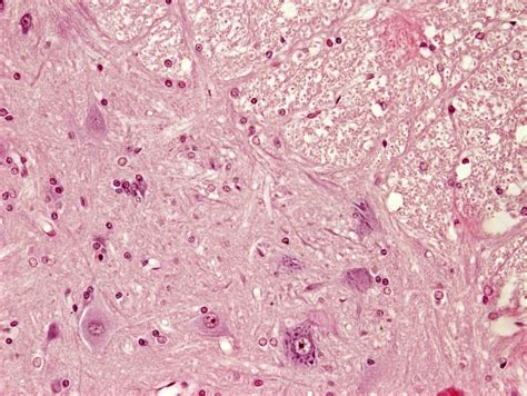 Tejidos Animales Nervioso Médula Espinal Atlas De Histología Vegetal